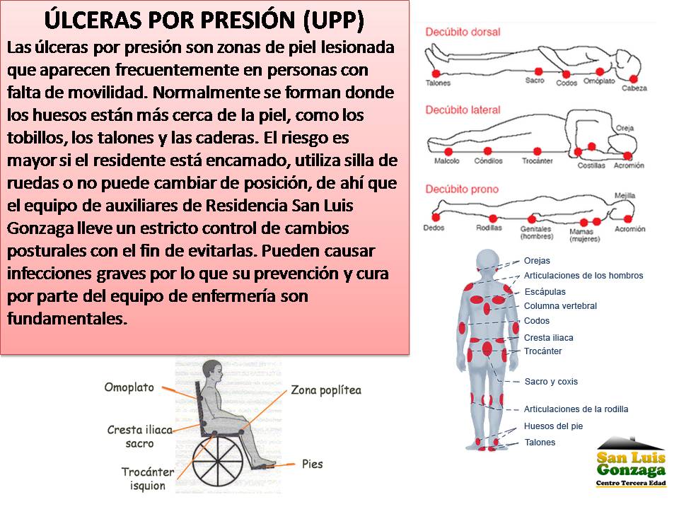 Residencia Tercera Edad. Prevención de úlceras en la piel
